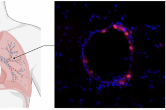 Welcome | Saltzman Research Group